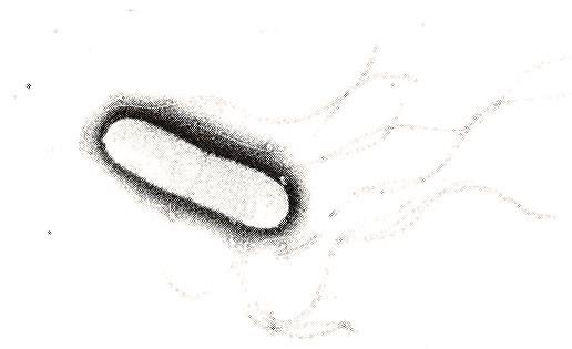 O157、O26感染注意島根今年20人 過去5年最多 | 山陰中央新報デジタル